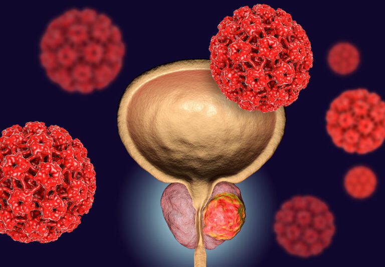 BPH Treatment - Urologist | Dr. Akhil K. Das ﻿| BPH & Lower Urinary ...